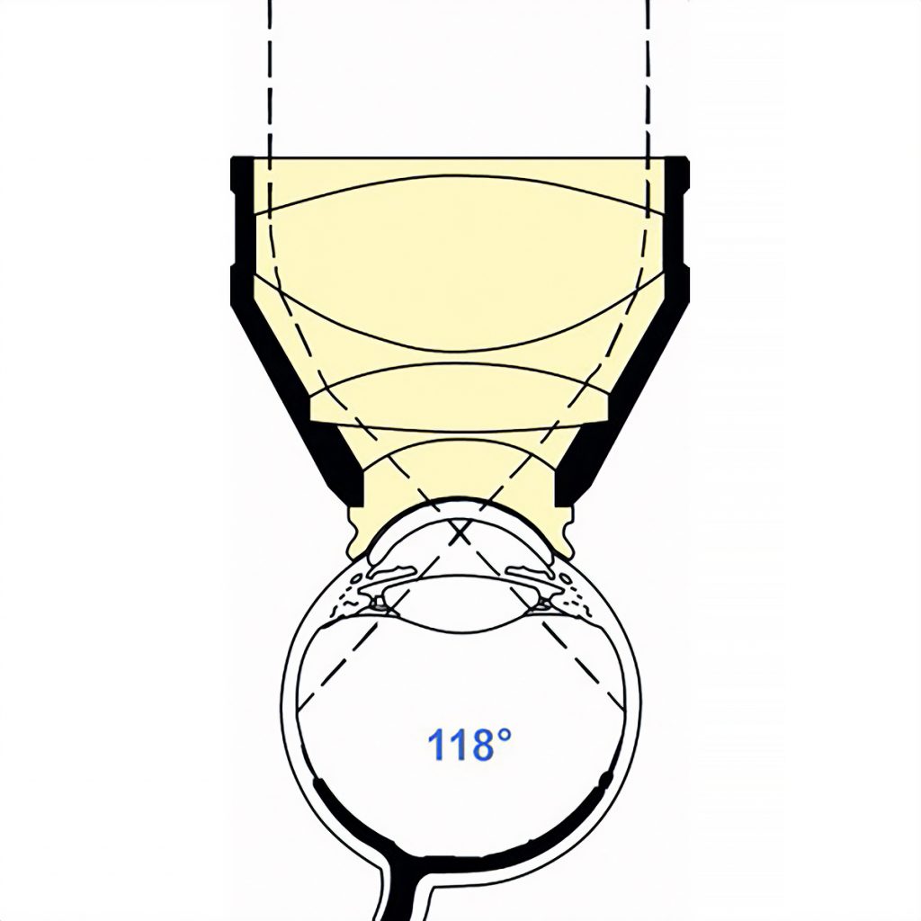 Viewlight Ocular 20D Indirect Lens - Ophthalmic Products