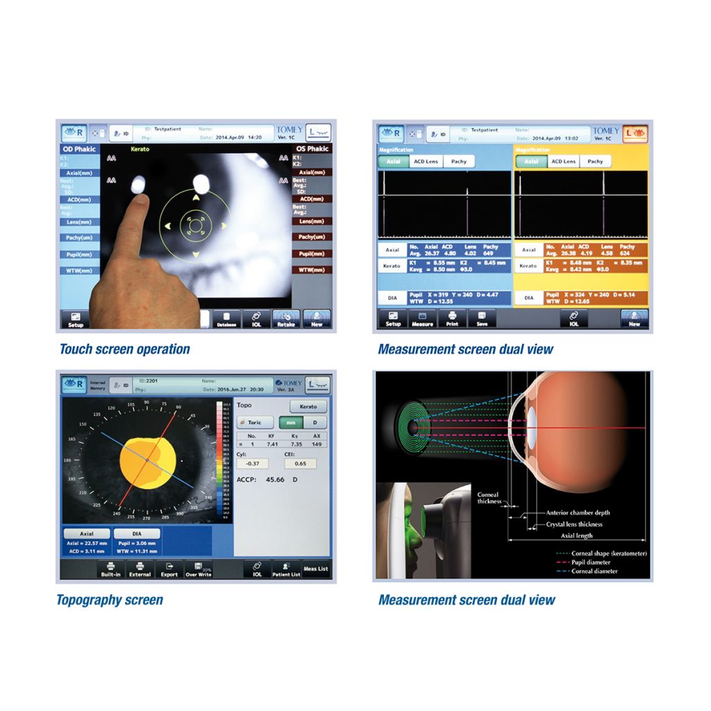 TOMEY Ultrasound UD-800 AB - Ophthalmic Products